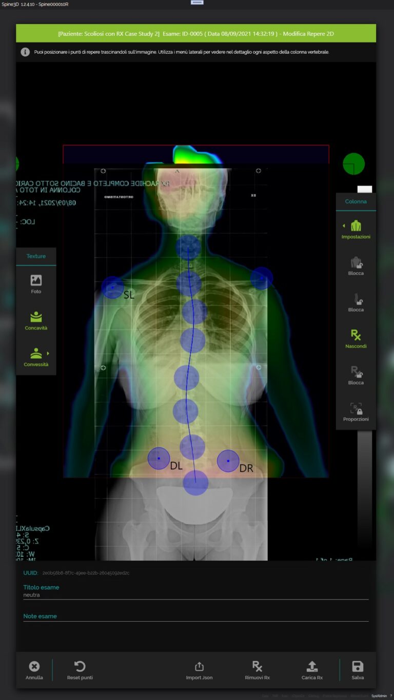 Non-invasive 3D scan of the spine - Posture Analysis