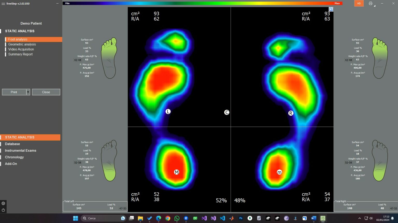 Professional Foot & Gait Analysis - Baropodometric platforms