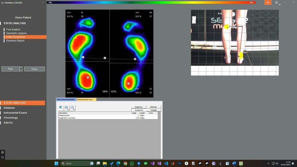 Professional Foot & Gait Analysis - Baropodometric platforms