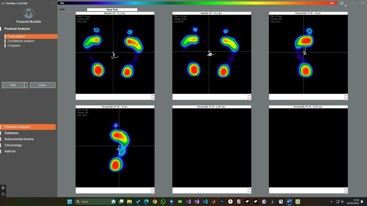 Professional Foot & Gait Analysis - Baropodometric platforms