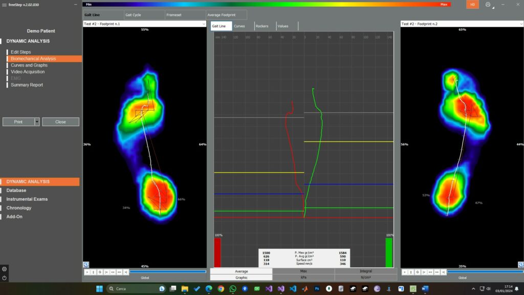 Professional Foot & Gait Analysis - Baropodometric platforms