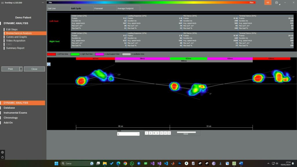 Professional Foot & Gait Analysis - Baropodometric platforms
