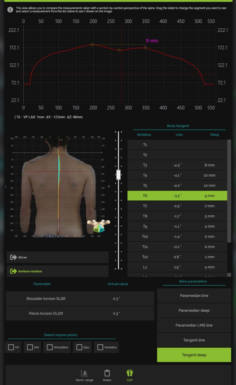Non-invasive 3D scan of the spine - Posture Analysis