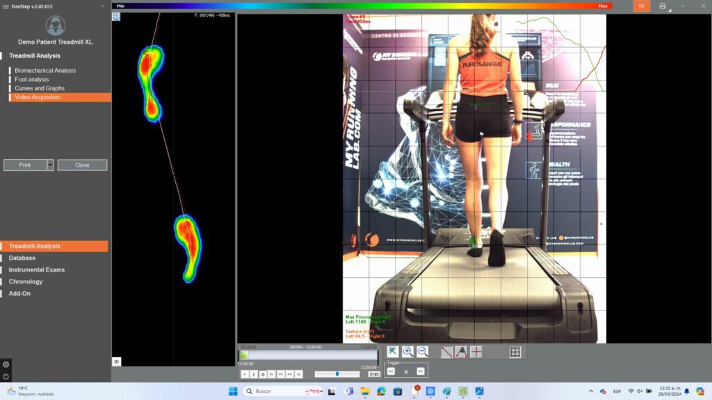 Gait & Run analysis - RunTime XL - Baropodometric Treadmill