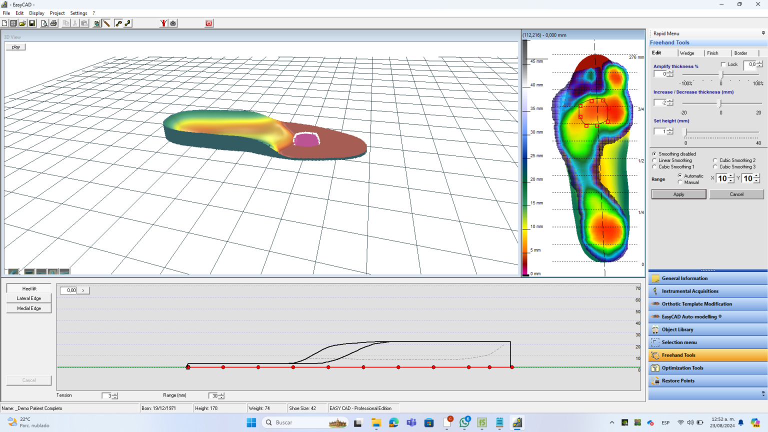 Insole modeling software - easyCAD insole - Sensor Medica