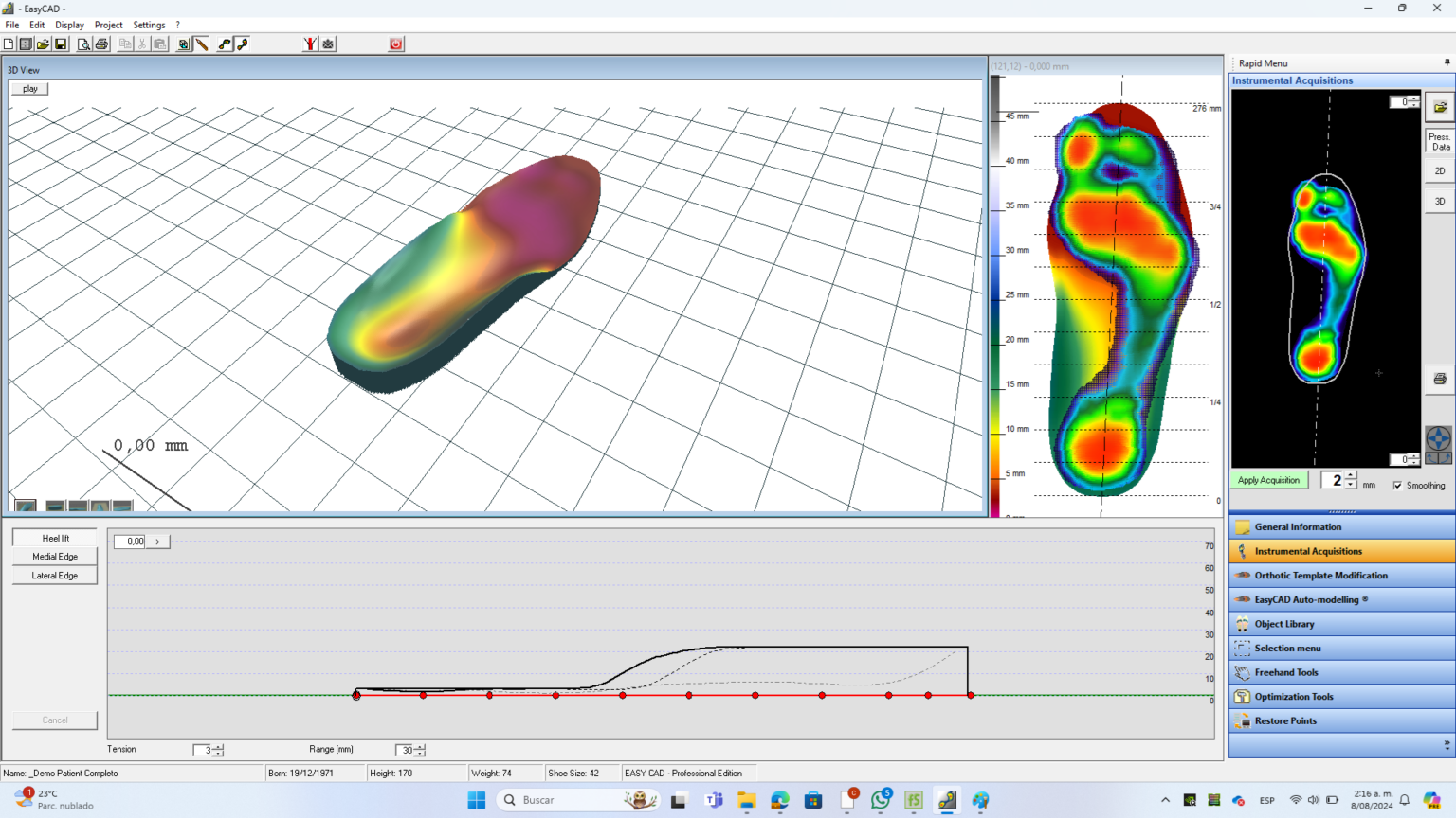 Insole modeling software - easyCAD insole - Sensor Medica