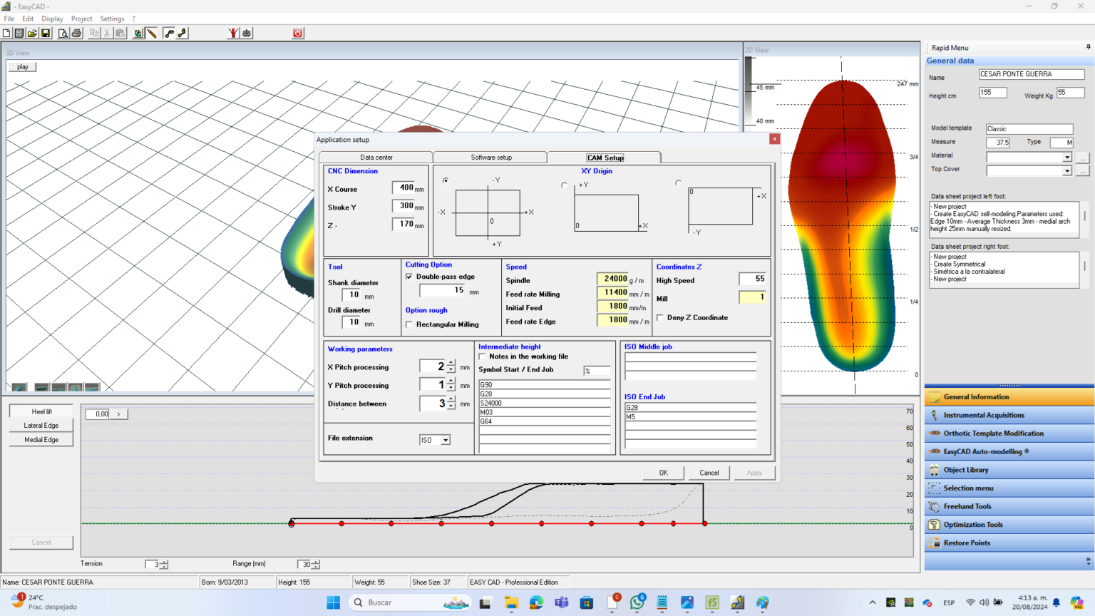 Insole modeling software - easyCAD insole - Sensor Medica
