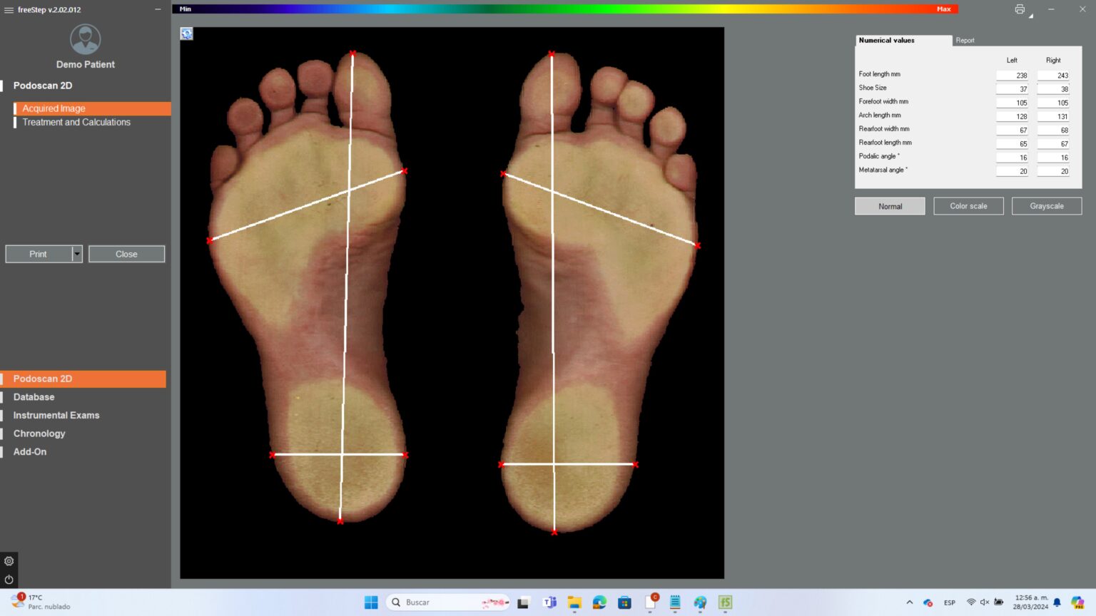 2D Digital Scan of foot - Podoscan 2D - Sensor Medica