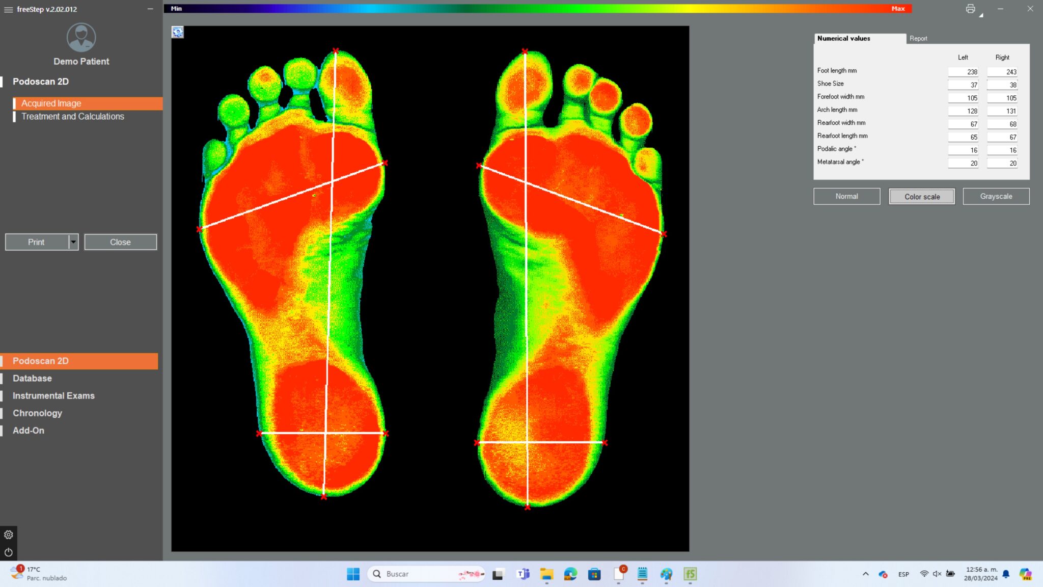 2D Digital Scan of foot - Podoscan 2D - Sensor Medica