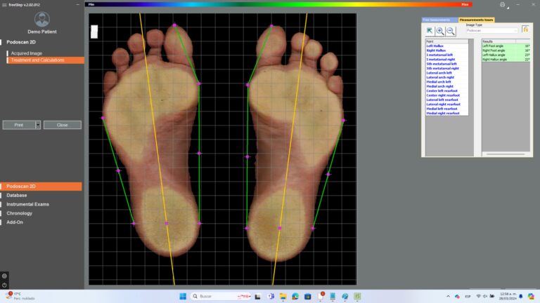 2D Digital Scan of foot - Podoscan 2D - Sensor Medica